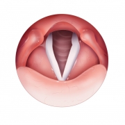 Vocal Fold Implants • Cytophil, Inc.
